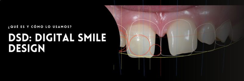 Software DSD en Odontología: Diseño Digital de la Sonrisa